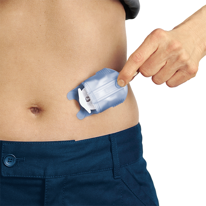 inset™ 30 infusion system 13mm Cannula/23" Tubing with Luer Lock (10 ...