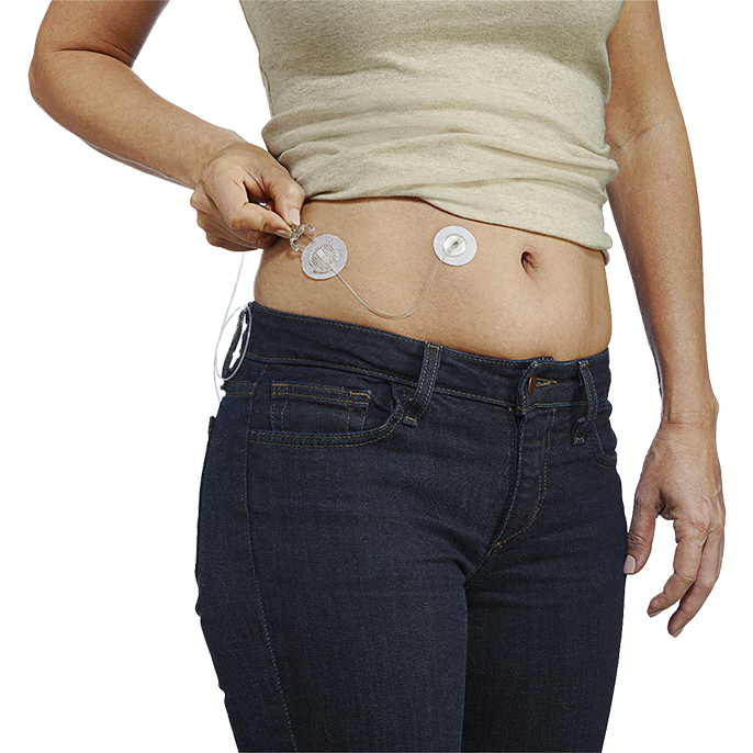 contact™ Detach infusion set 8mm Cannula/43" Tubing with Luer Lock (10 ...