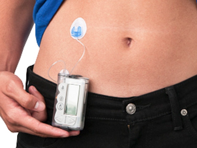 MiniMed™ mio™ 6mm Cannula / 32" Tubing BLUE (10/box) | Diabetes Shop